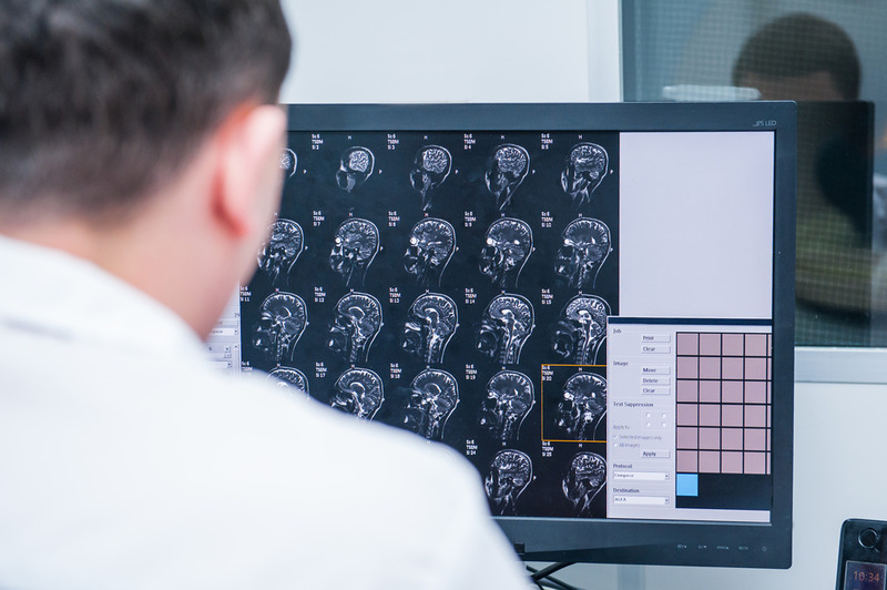 Top LA Traumatic Brain Injury Attorney: The Process of Filing a TBI Claim